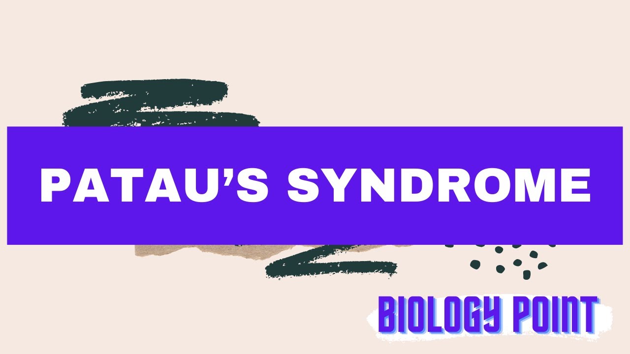 Patau Syndrome || Trisomy 13 || Bartholin-Patau syndrome ||Causes ...