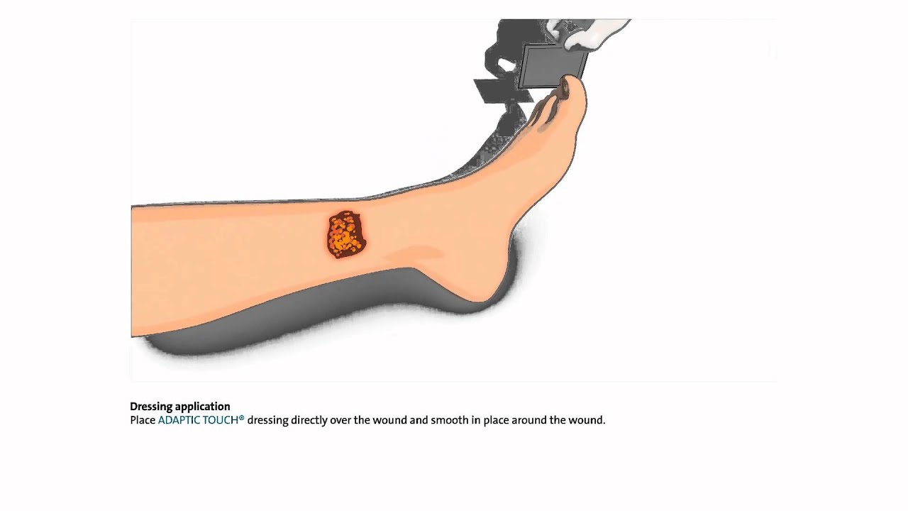 Adaptic Touch™ Non Adhering Silicone Dressing How To Use Youtube
