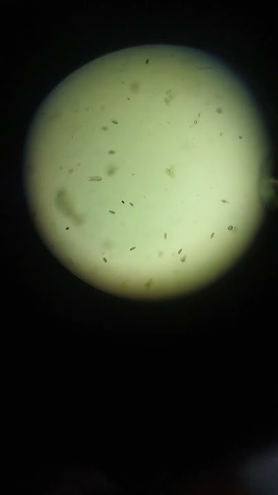Protists under microscope - YouTube