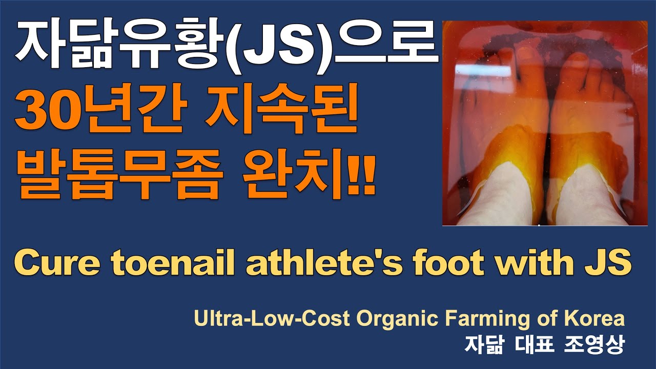 자닮유황(JS)로 30년 지속된 발톱무좀을 완치하다!! Cure toenail athlete's foot with JS ...
