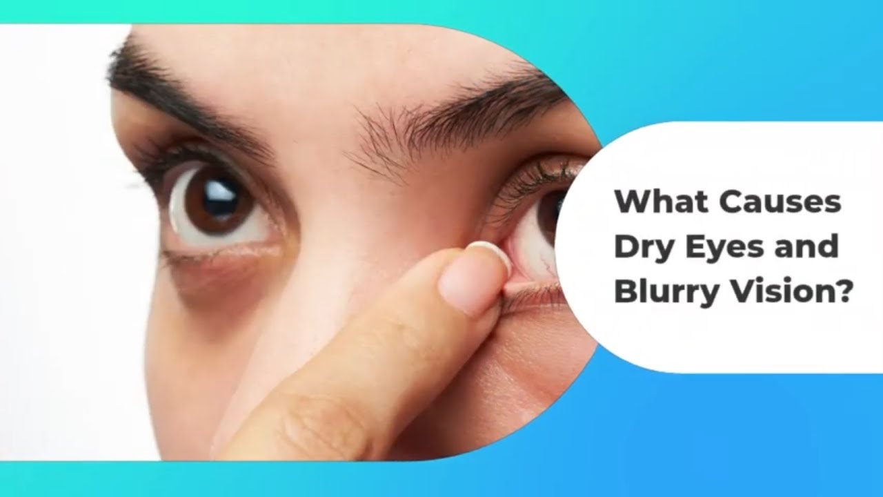What Causes Dry Eyes And Blurry Vision YouTube what-causes-dry-eyes-and-blurry-vision-youtube