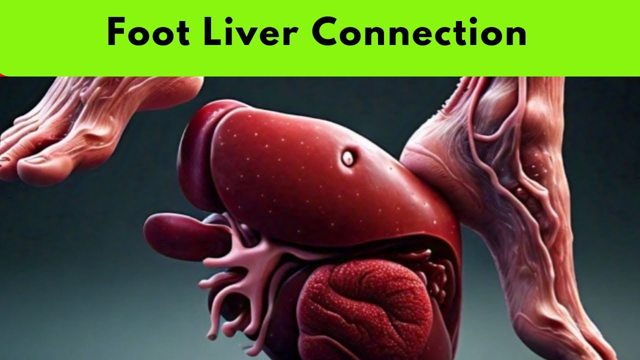 Spot Liver Problems With Foot Diagnosis | Foot Liver Connection | Fatty ...