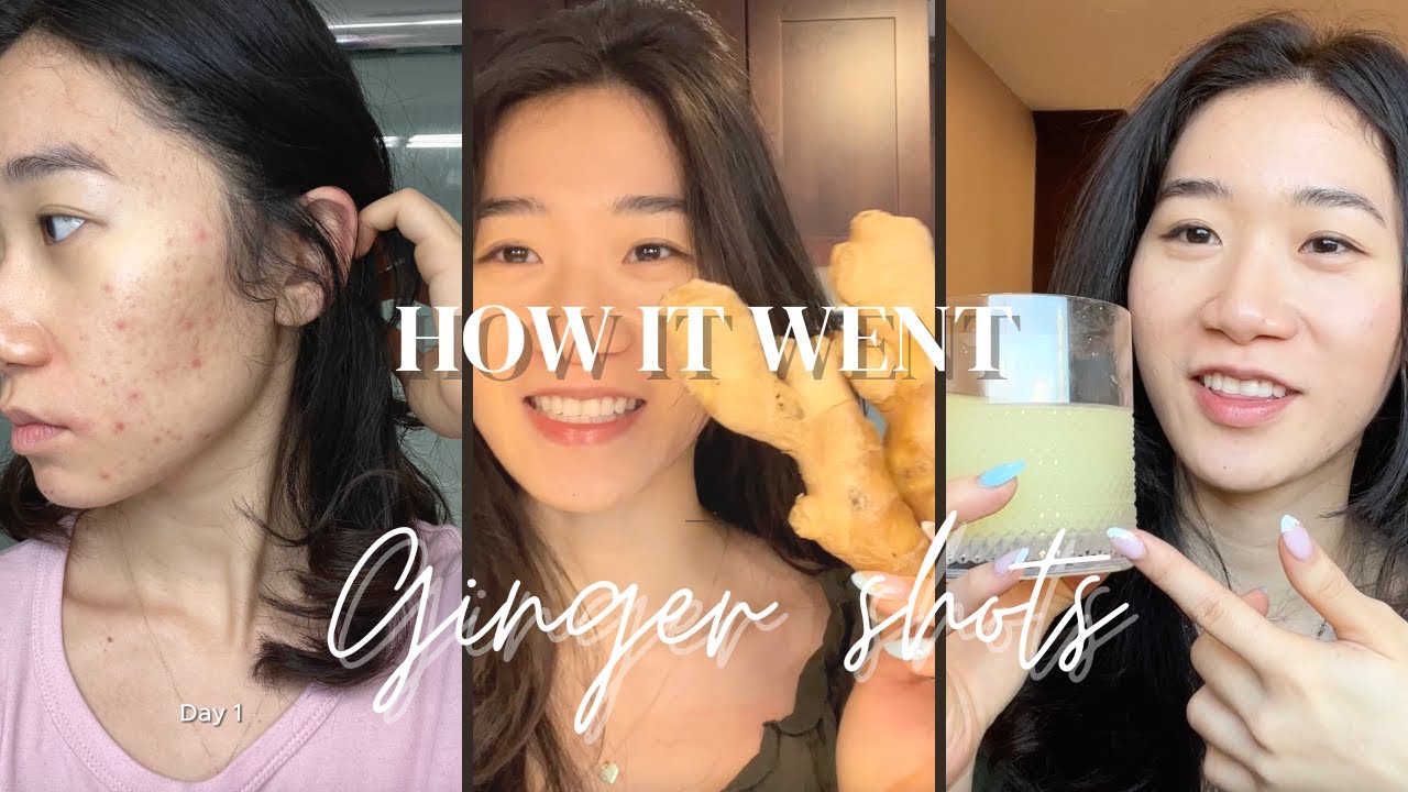 30 days of ginger shots for my acne prone skin - YouTube