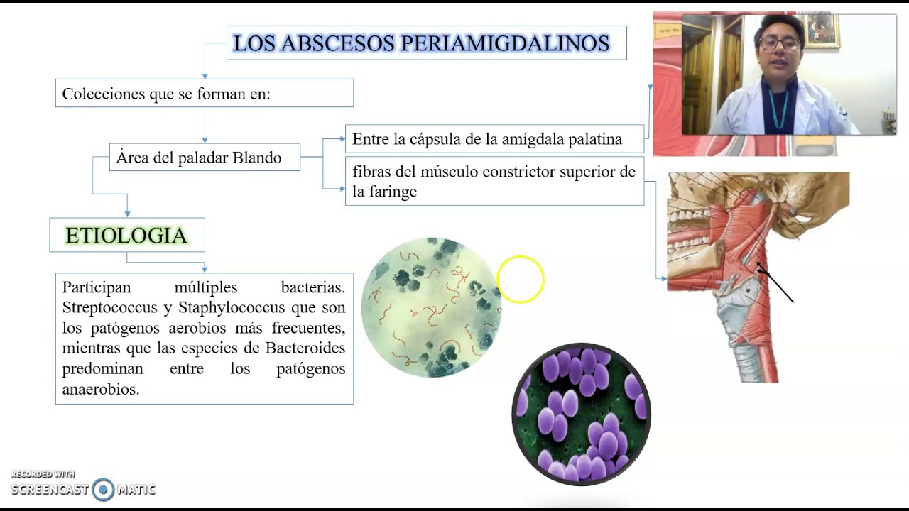 ABSCESO PERIAMIGDALINO - YouTube