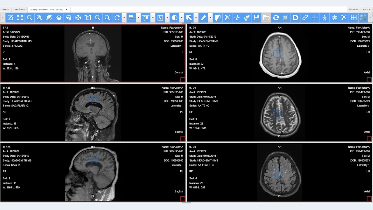 3D Cursor - LEADTOOLS Medical Web Viewer - YouTube