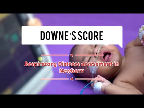 Downe's Score | How to calculate | Important Score in Neonates ...