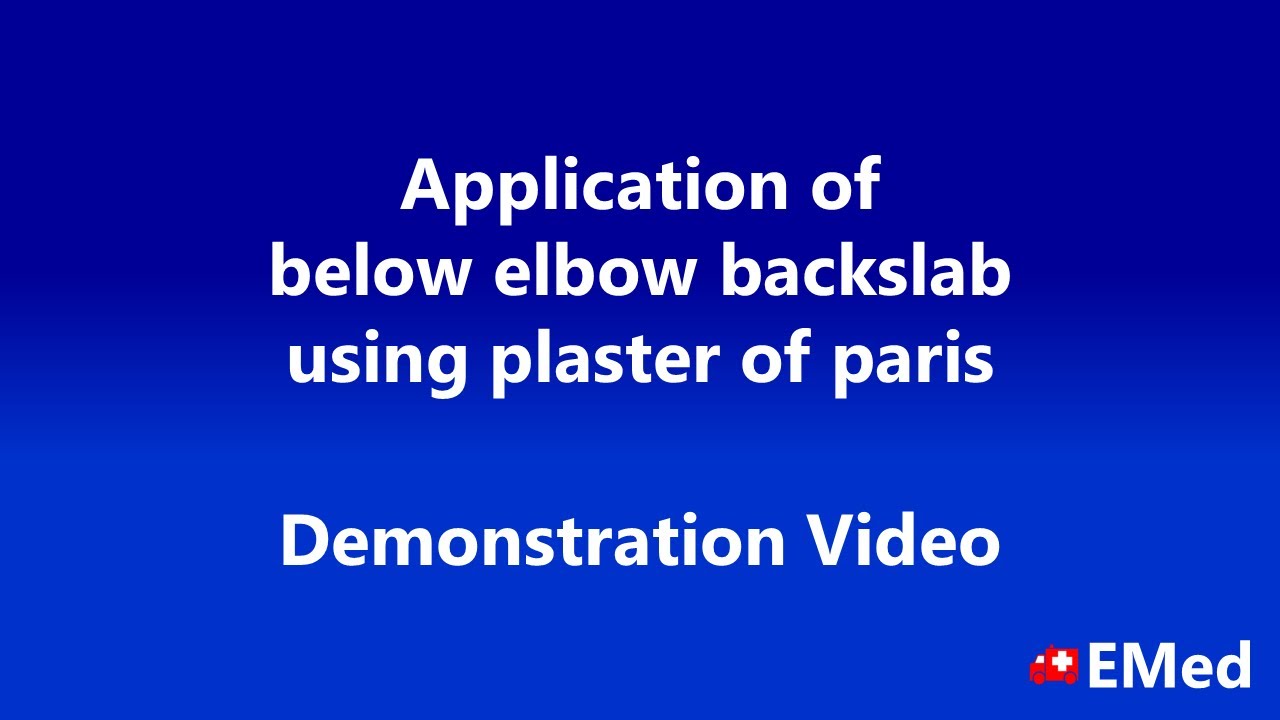 Application of Below Elbow Backslab Using POP - YouTube