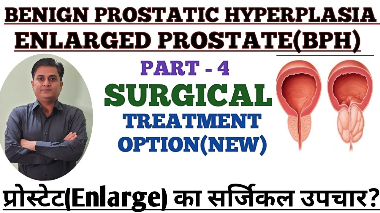 PROSTATE(ENLARGE PROSTATE-BPH)-Dr.SHIVALKAR.SURGICAL OPTION,NEWER ...