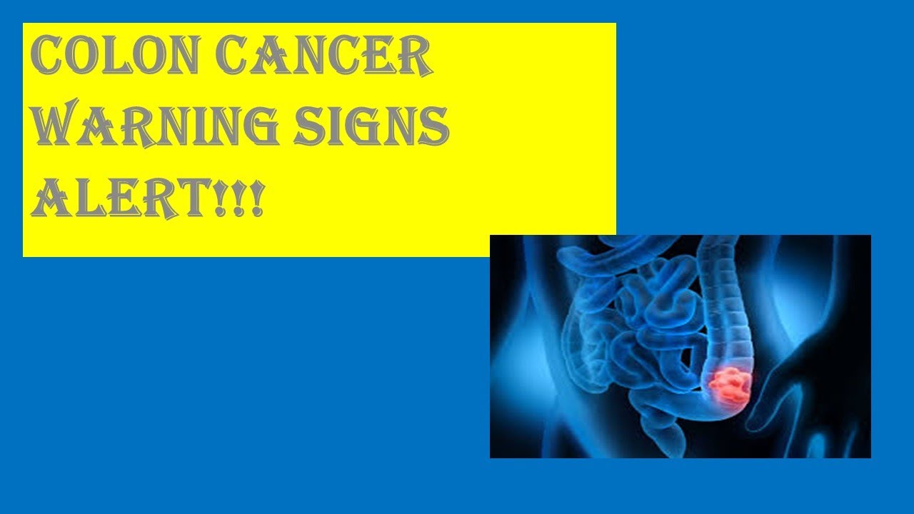 "Be Aware: Recognizing the Warning Signs of Colon Cancer" - YouTube