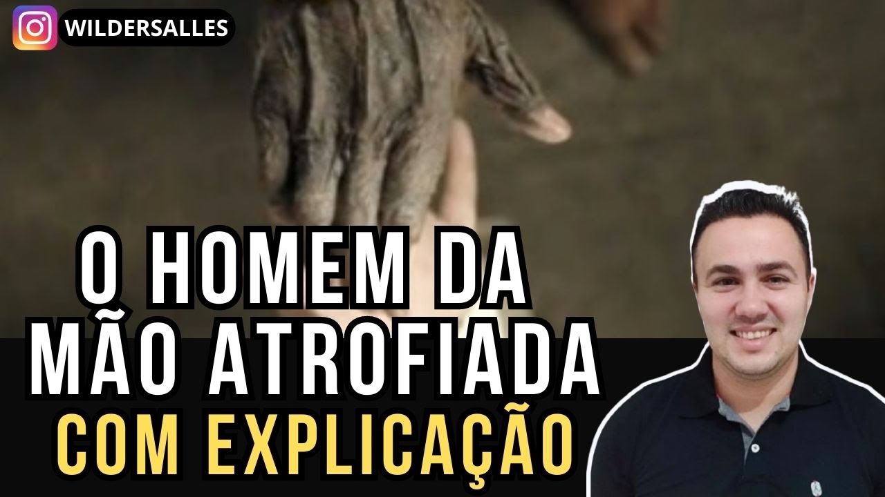 O HOMEM DA MÃO ATROFIADA (com explicação) - YouTube