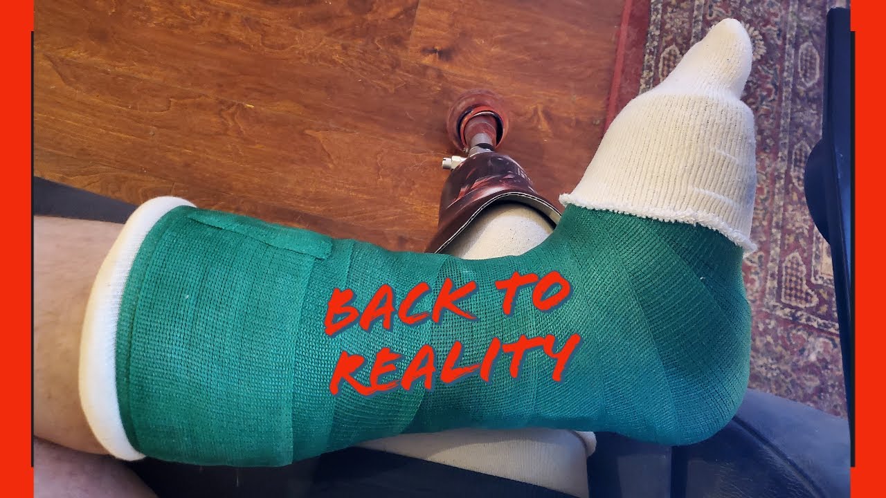 Time to take the cast off and go back to being disabled - YouTube