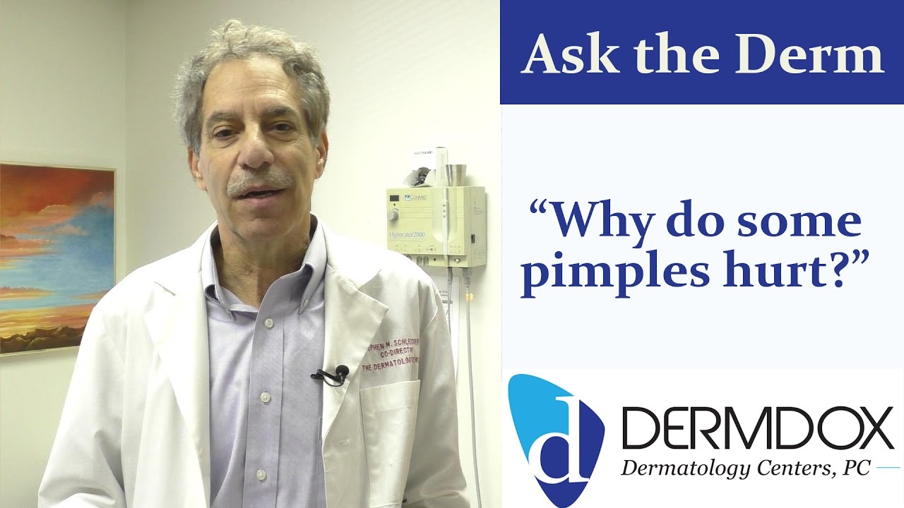 Ask the Derm - Why do pimples hurt? - YouTube