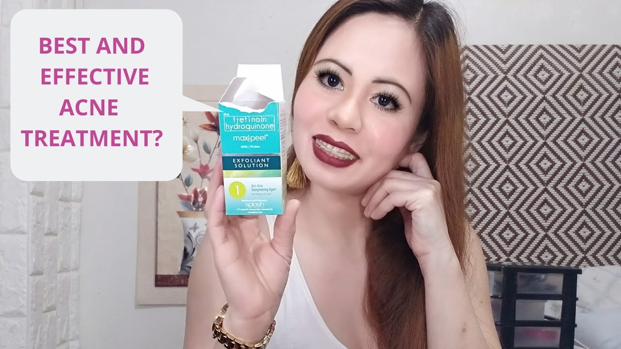 BEST AND EFFECTIVE ACNE TREATMENT:MAXI-PEEL EXFOLIANT SOLUTION #1 ...