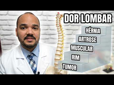 DOR LOMBAR : 5 Causas mais comuns