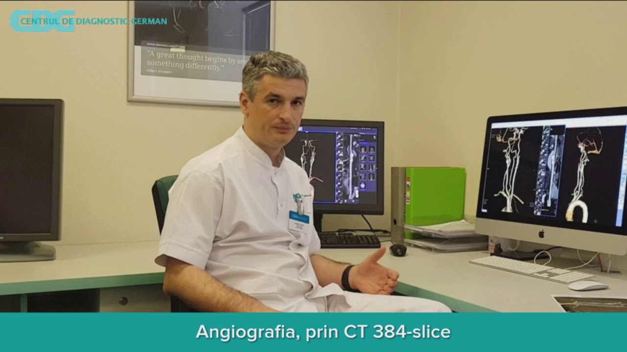 Ce este CT-Angiografia? - YouTube