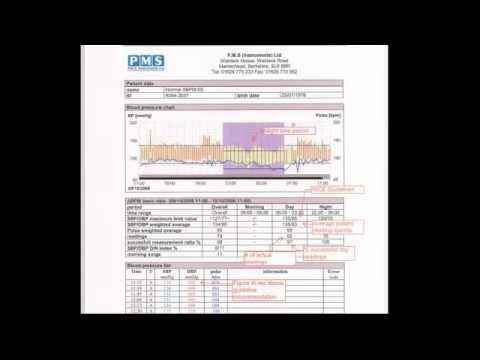 Meditech ABPM-04 +05 attaching to SystmOne - YouTube