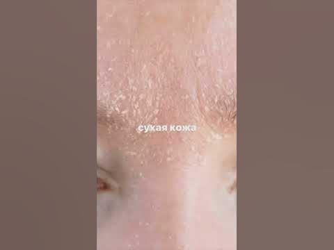 Уход за кожей (сальные нити, сухость, расширенные поры) - YouTube