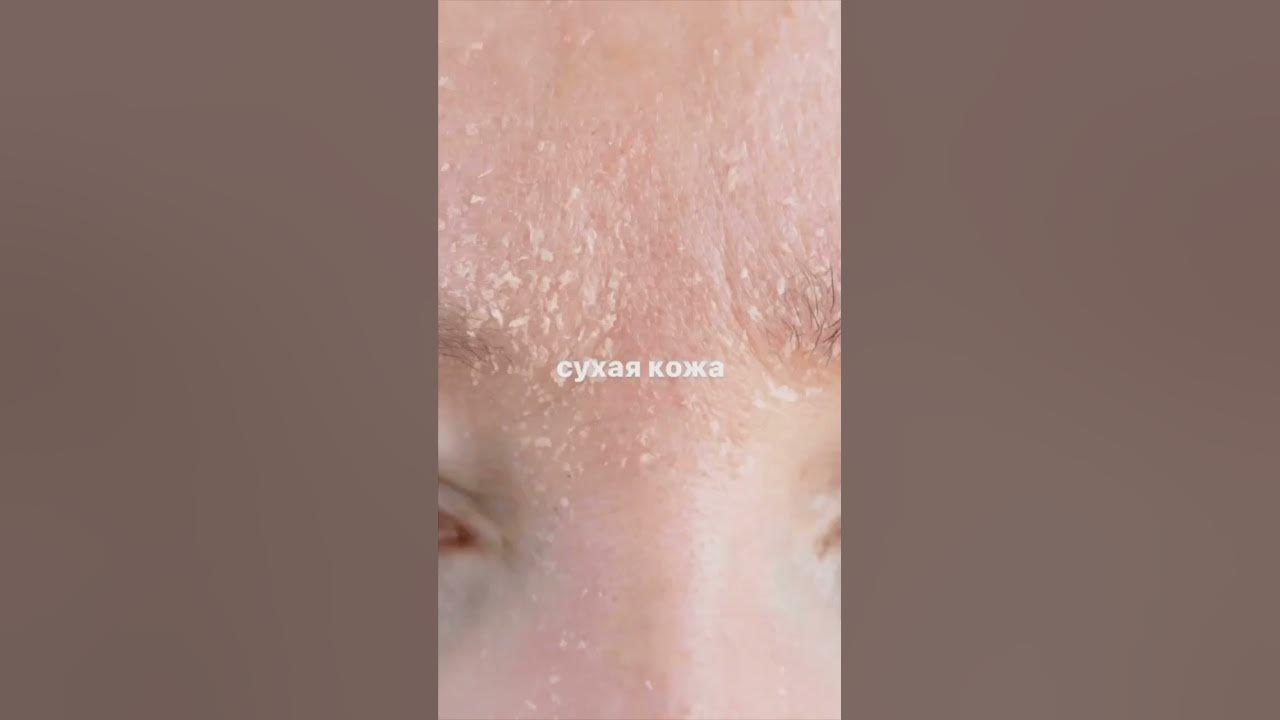 Уход за кожей (сальные нити, сухость, расширенные поры) - YouTube