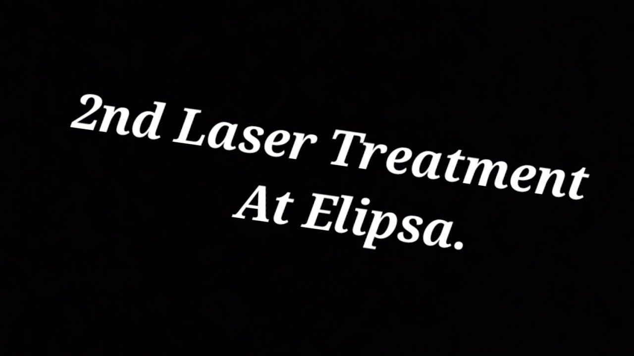 2nd Laser Treatment at Elipsa to remove Hyperpigmentation # ...