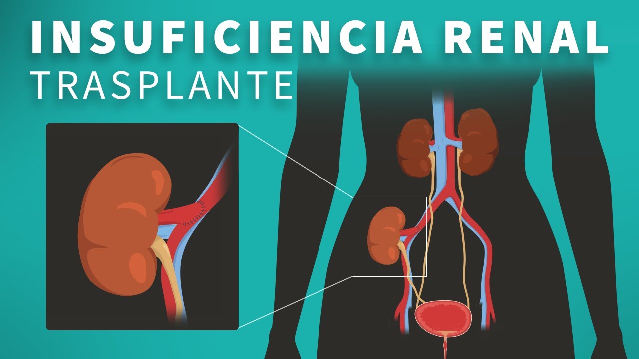 Insuficiencia renal terminal (ESRD): Causas, síntomas y opciones de tratamiento - YouTube