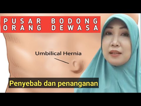 PUSAT BODONG Pada ORANG DEWASA || HERNIA UMBILIKAL