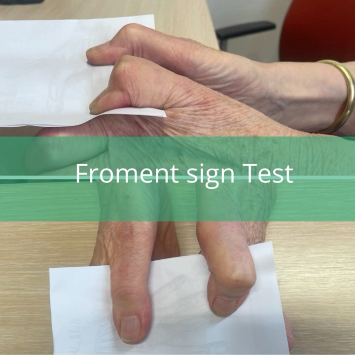 Froments Test explained #handsurgeon #medicaleducation #ulnarnerve # ...
