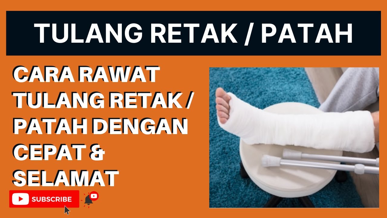 Cara Rawat Tulang Retak Dengan Cepat & Selamat - YouTube
