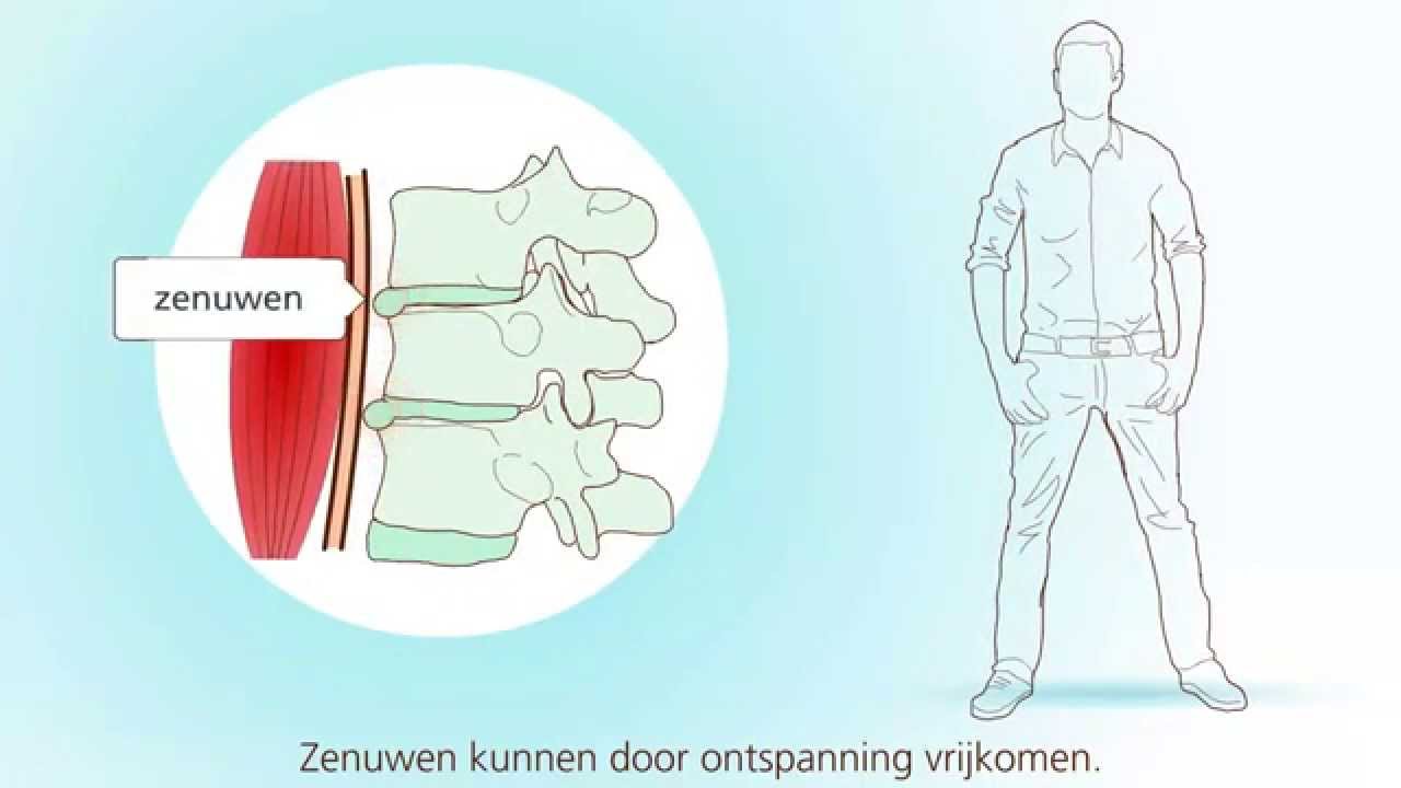 Rug en nekpijn door een bekkenscheefstand - YouTube