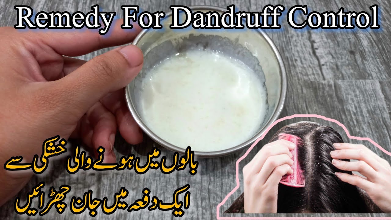 What Is Dandruff? Causes & Treatment | How To Treat Dandruff At Home ...