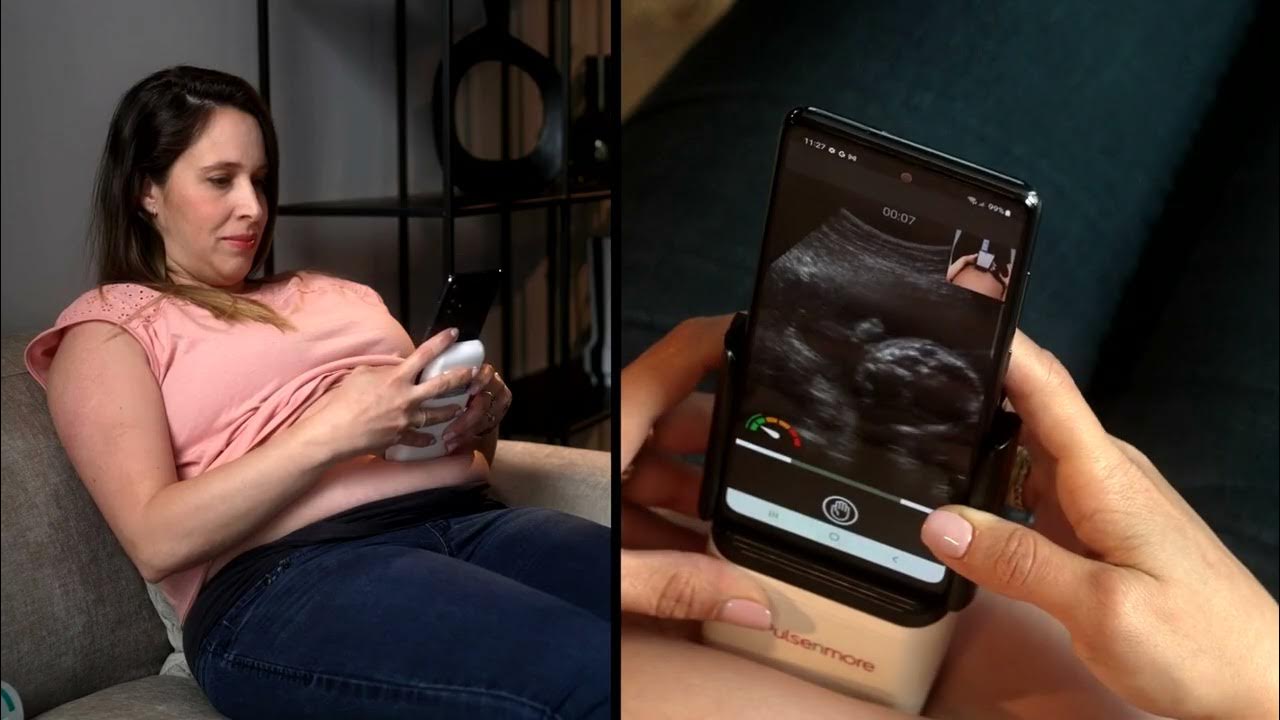 Pulsenmore's Home Ultrasound - App-Guided Mode - YouTube
