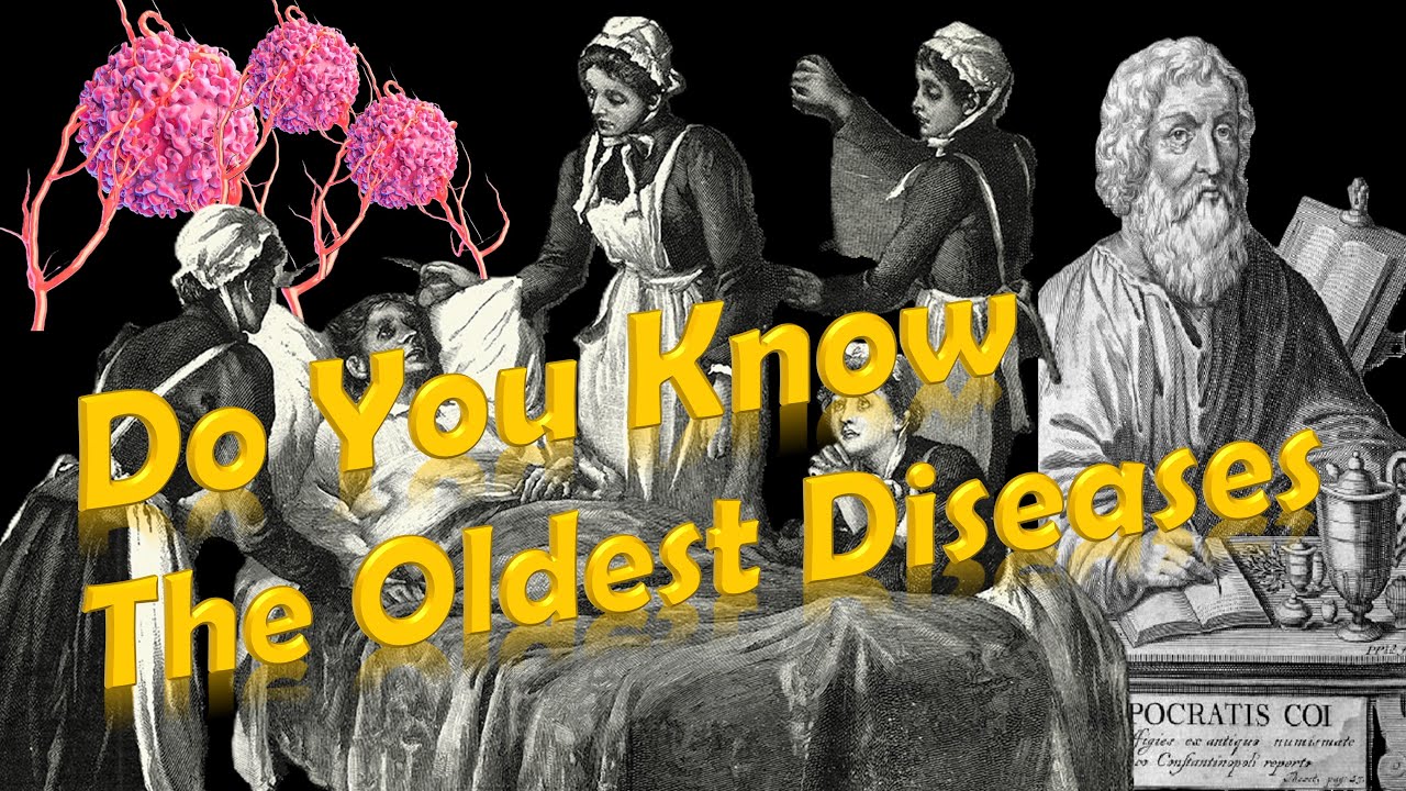 The Secrets of Ancient Diseases | Exploring the Oldest Ailments Known ...