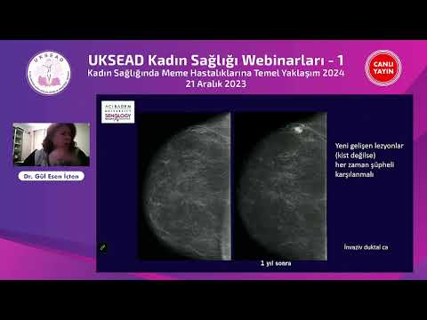 UKSEAD Kadın Sağlığı Webinarları 1- Kadın Sağlığında Meme Hastalıklarına Temel Yaklaşım 2024