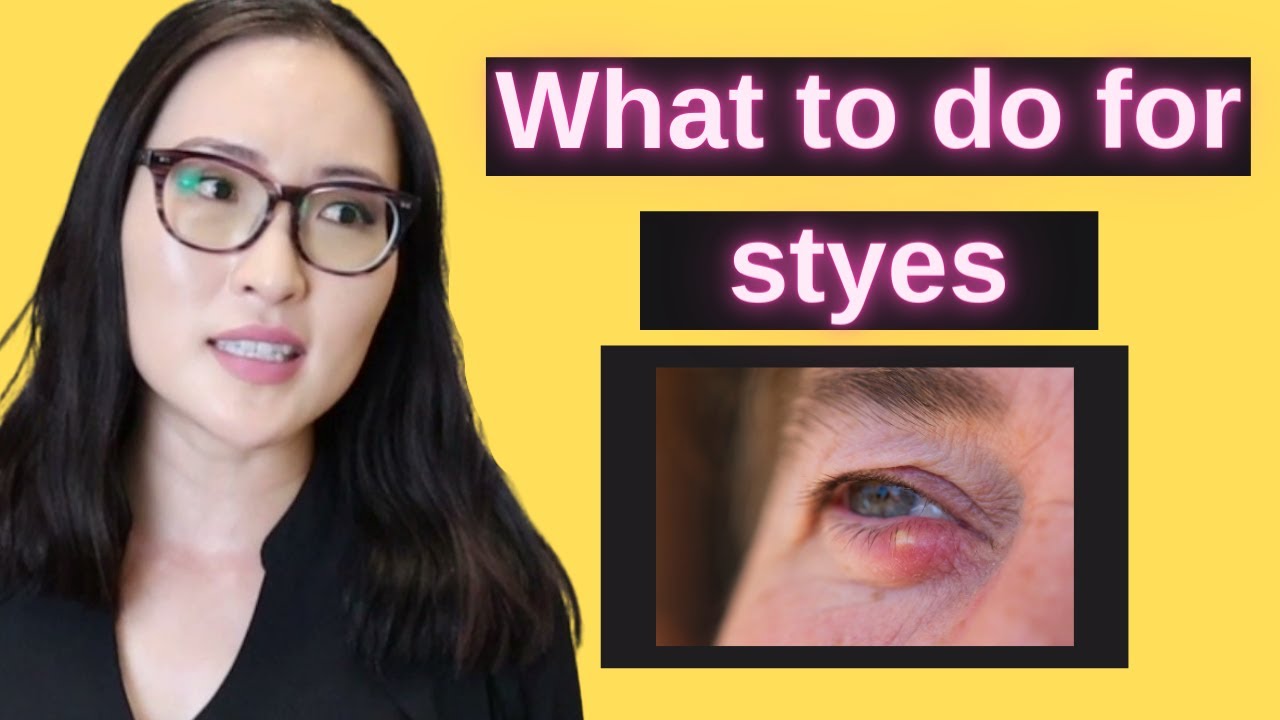 How to get rid of a stye at home using natural, over the counter ...