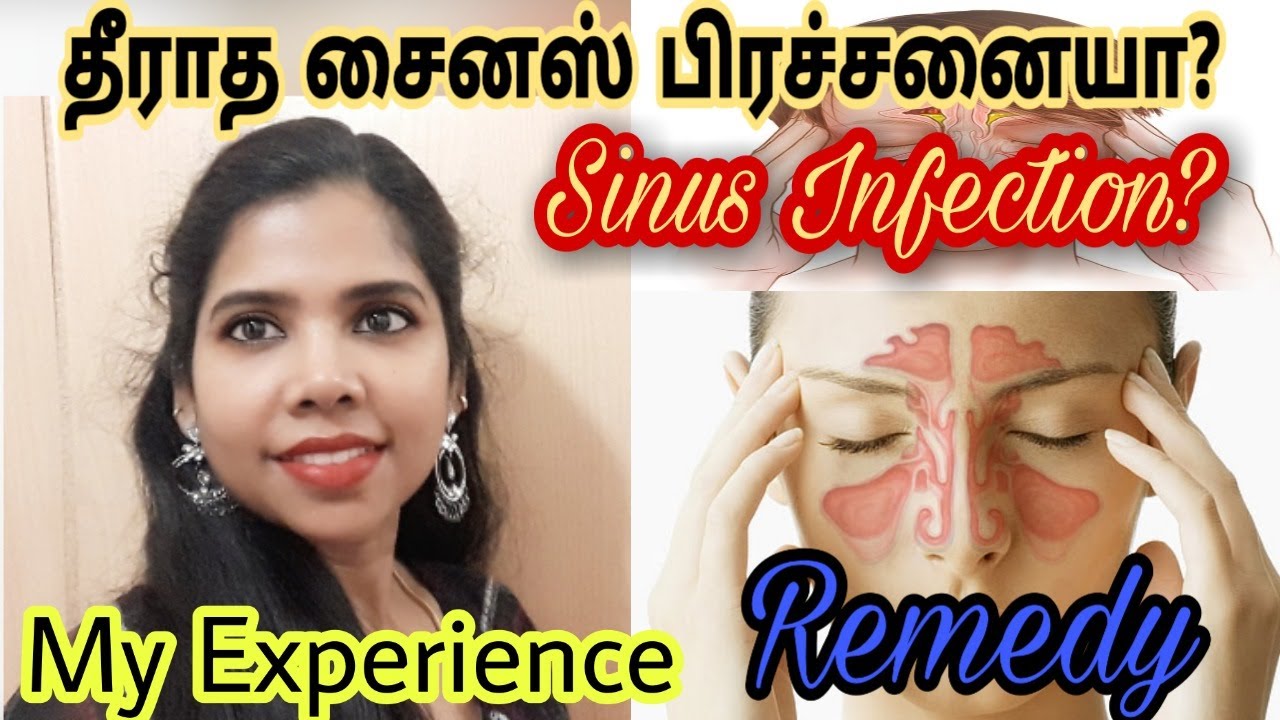 Home Remedy For Sinus Problem In Tamil How Home Remedy For Sinus Problem In Tamil How