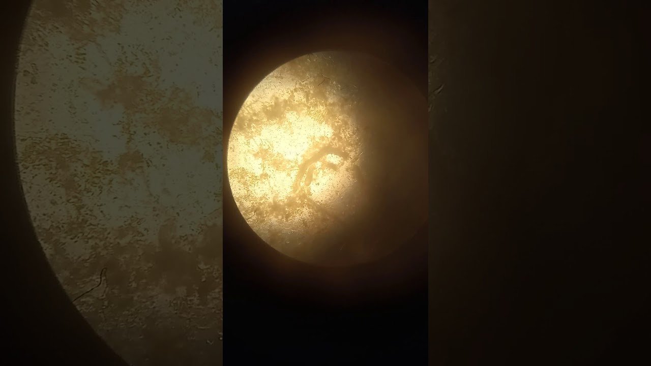 Movement of Rumen Microflora - YouTube