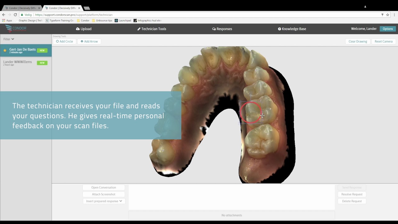 Condor intra oral scanner - Video 5 - YouTube