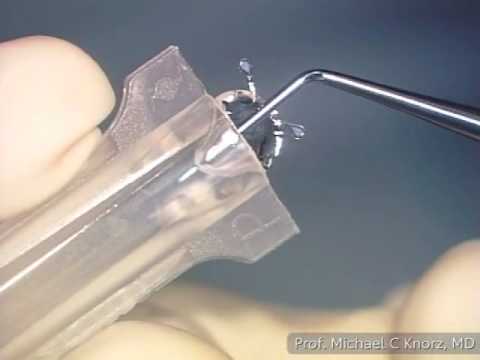 Prof. M. Knorz: Acrysof Cachet Phakic IOL Implant / Implantation - 1 ...