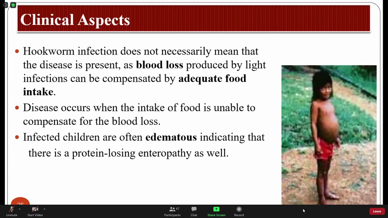 Hookworms part 2 Lecture 16th Microbiology Gastrointestinal System BY ...