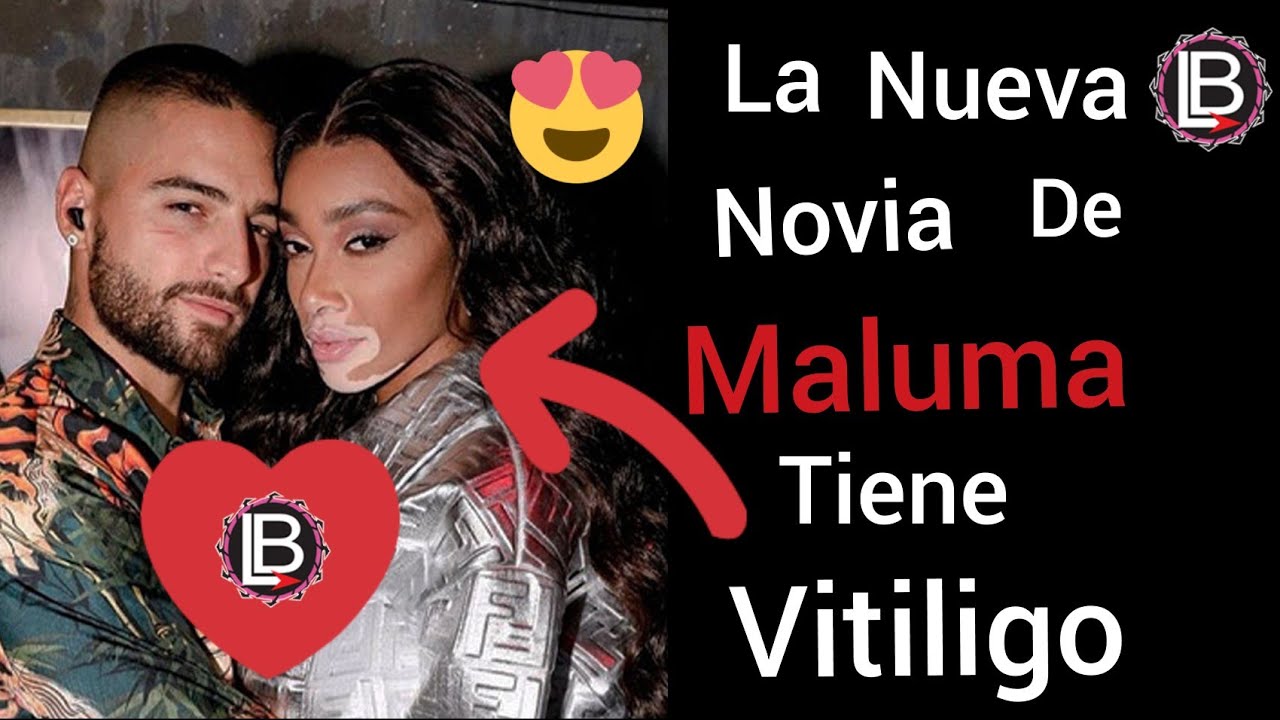 Winnie Harlow? La nueva novia de Maluma que tiene vitiligo - YouTube
