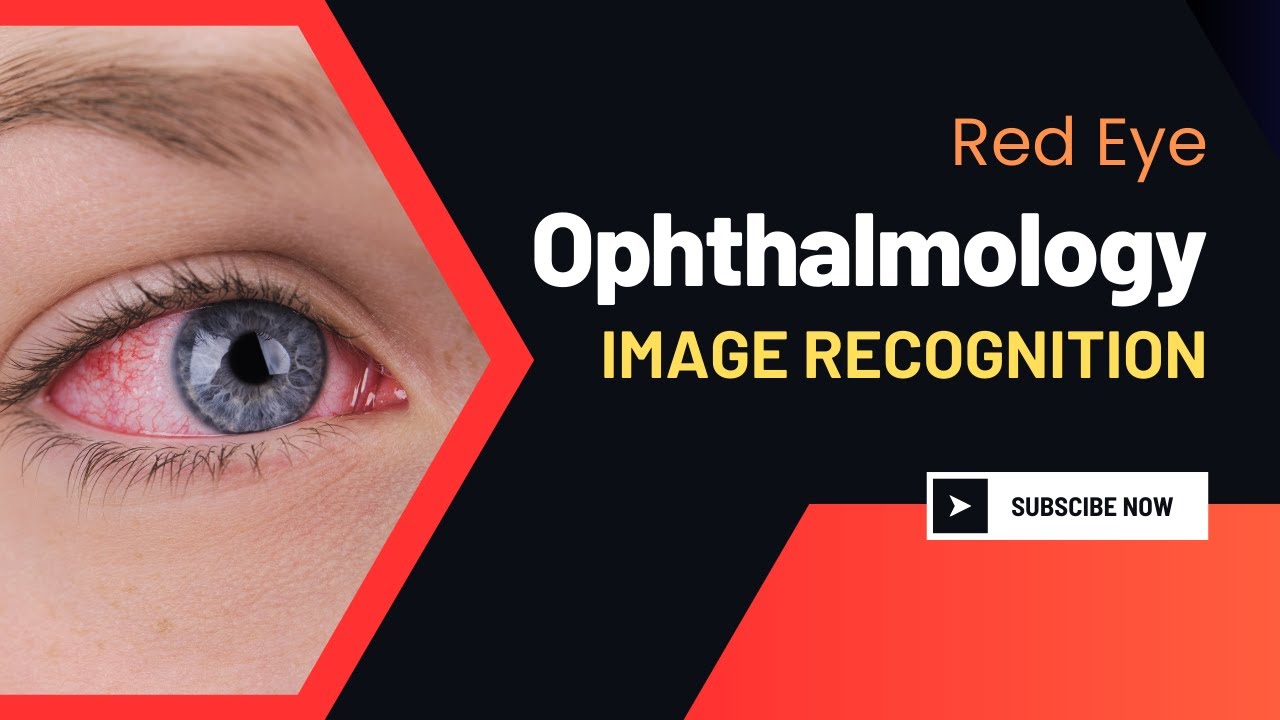Ophthalmology Image Recognition: Red Eye - YouTube