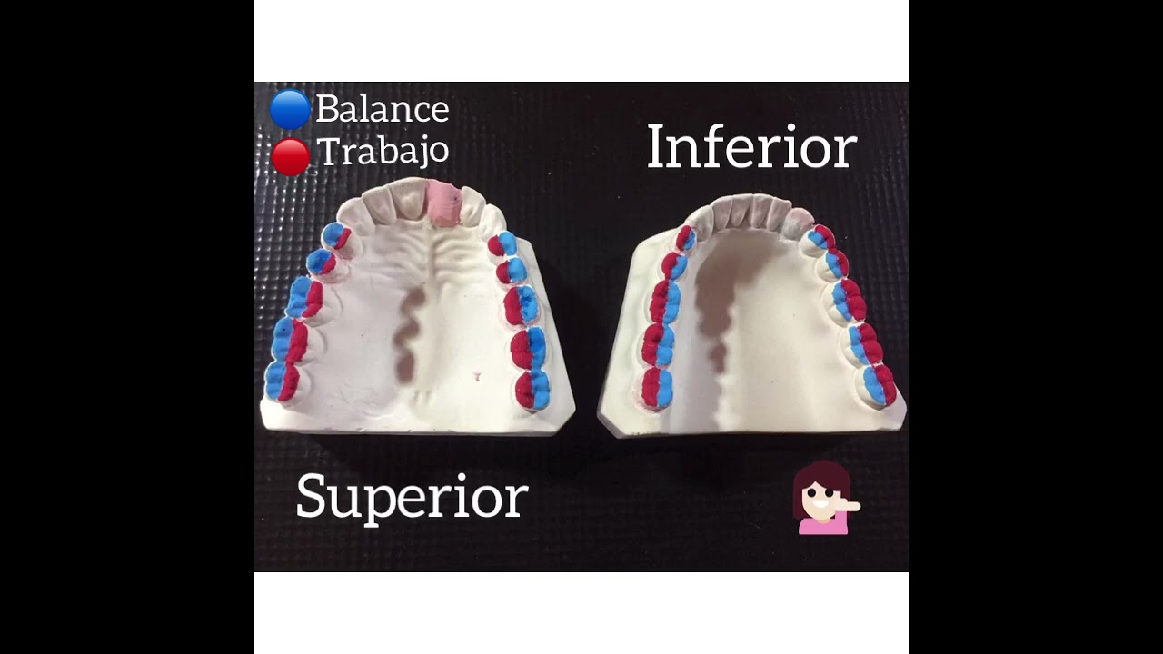 Surcos y Cúspides en oclusión, Movimientos Mandibulares y Contactos ABC ...