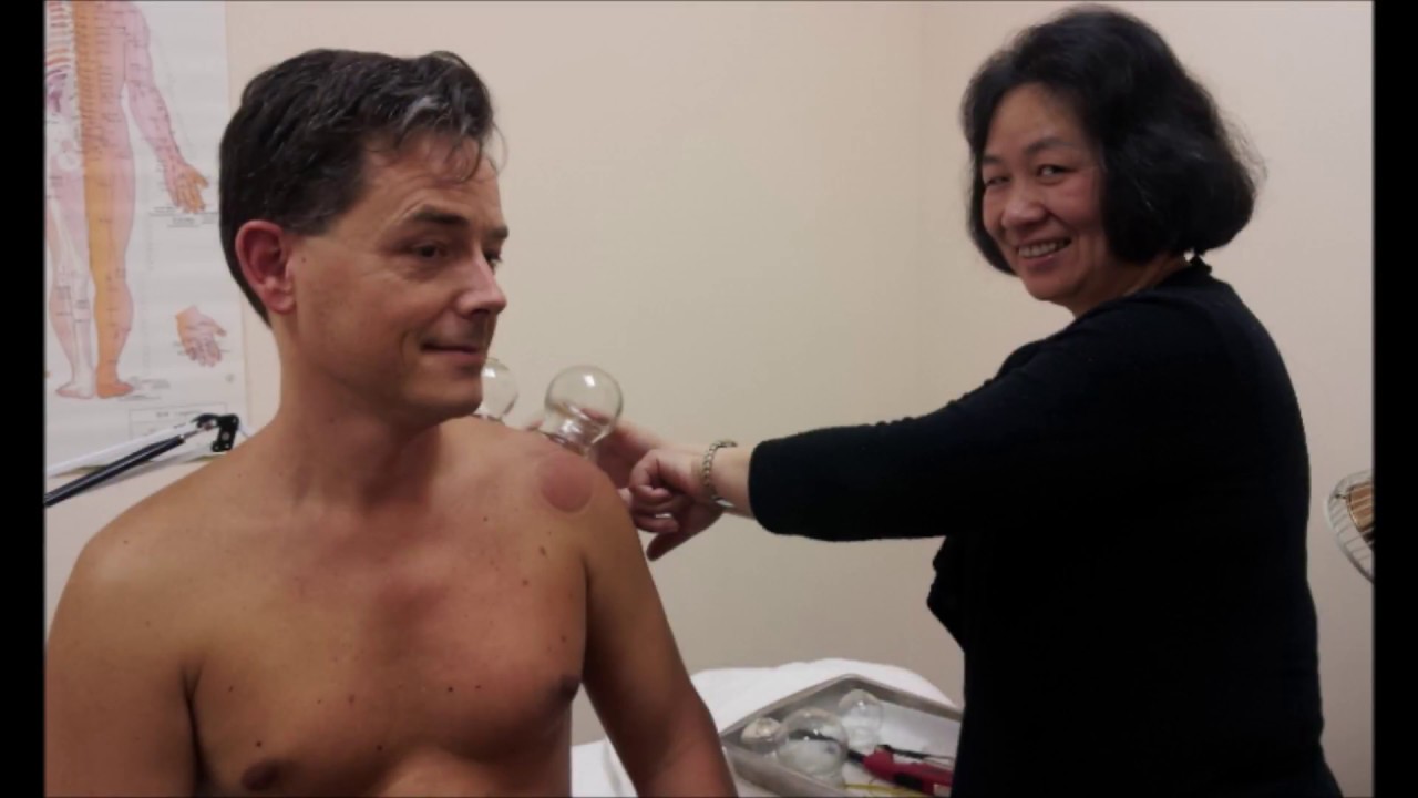 Acupuncture Interview with Dr. Fang Mu - YouTube