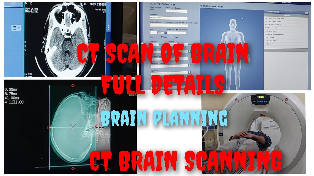 How to do CT scan of brain in GE machine | CT Brain Planning| CT scan ...