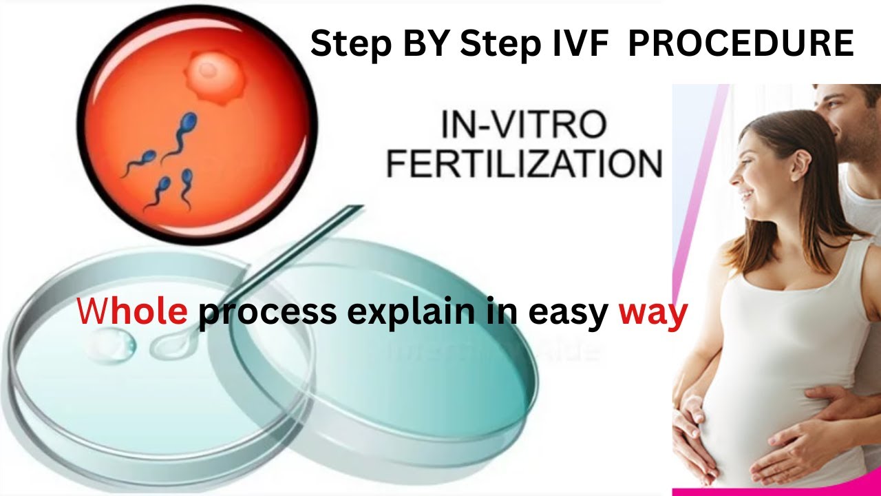 @tichjohn-sd2wkIN vitro fertilization whole process Explain in easy way ...