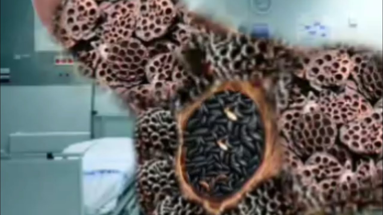 Asmr leg treatment animation|ASMR massage leg and remove sleep - YouTube