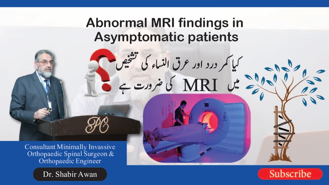 Abnormal findings in MRI of asymptomatic Patients - YouTube