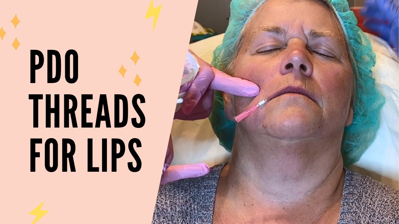 PDO Threads for Lips | Part 2 of PDO Threads - YouTube