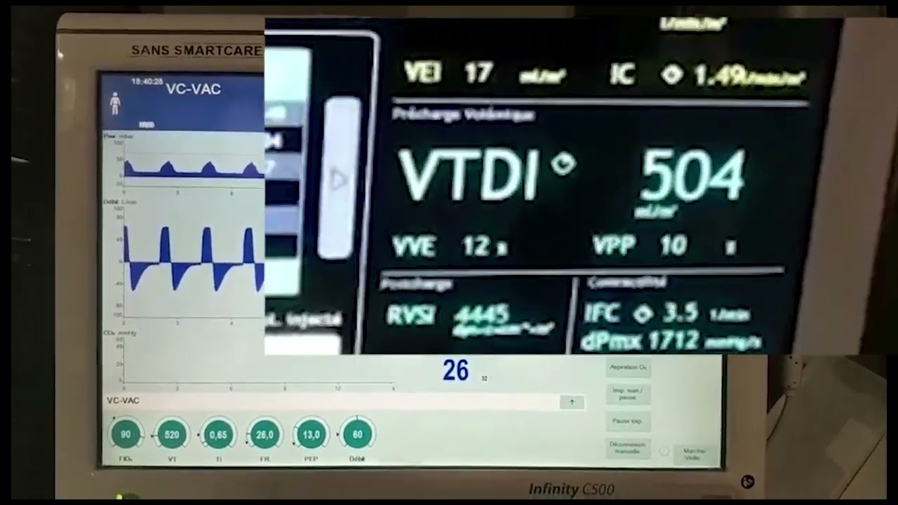 A2 Tidal Volume Challenge - YouTube