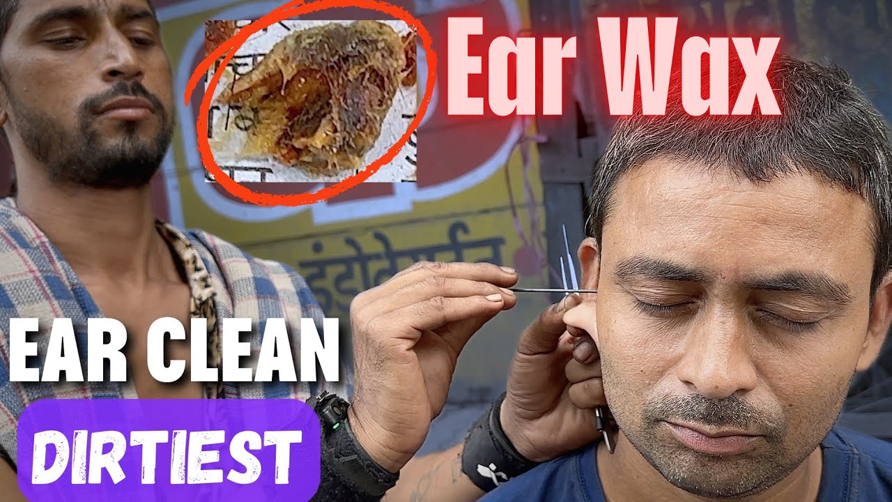 Dirtiest Ear Wax found During Ear Cleaning at Street Side Ear Cleaner ...