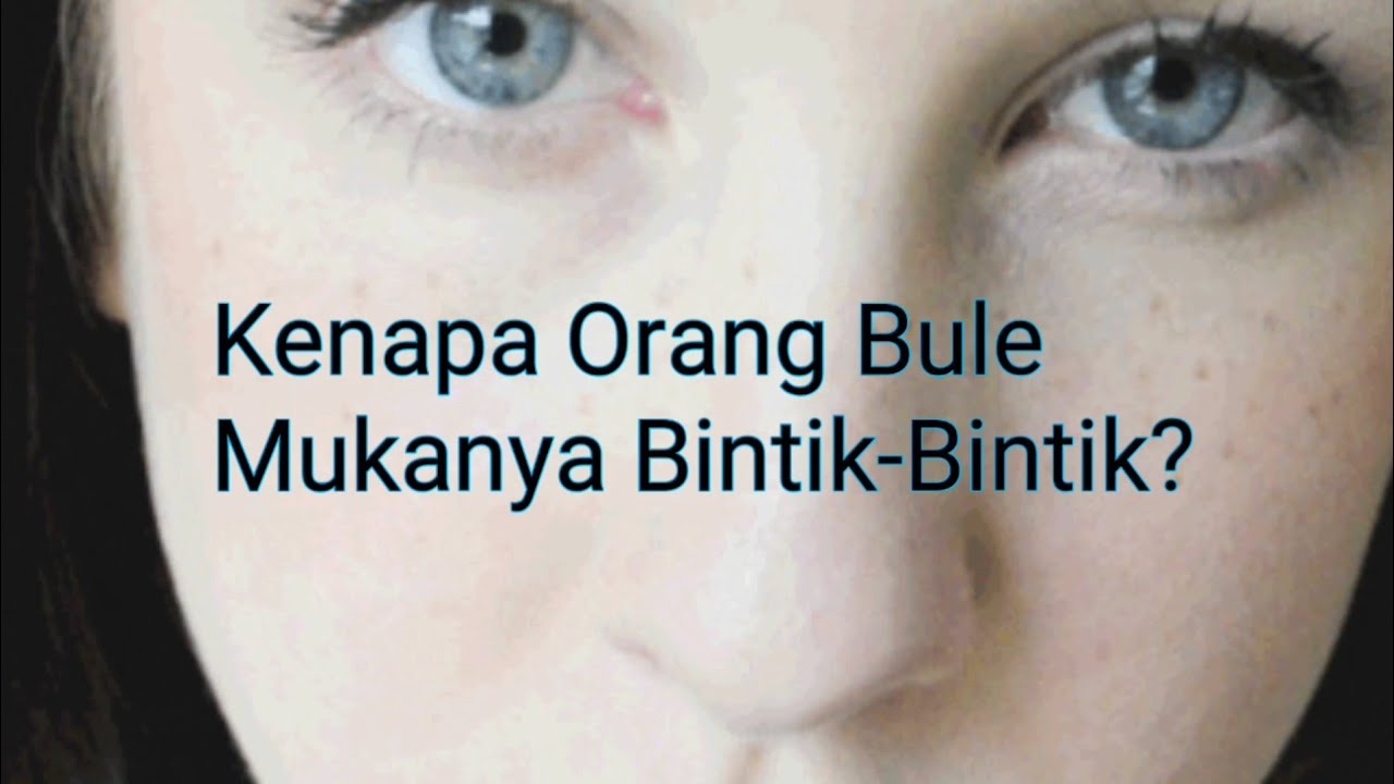 Kenapa Orang Bule Mukanya Bintik-Bintik? - YouTube